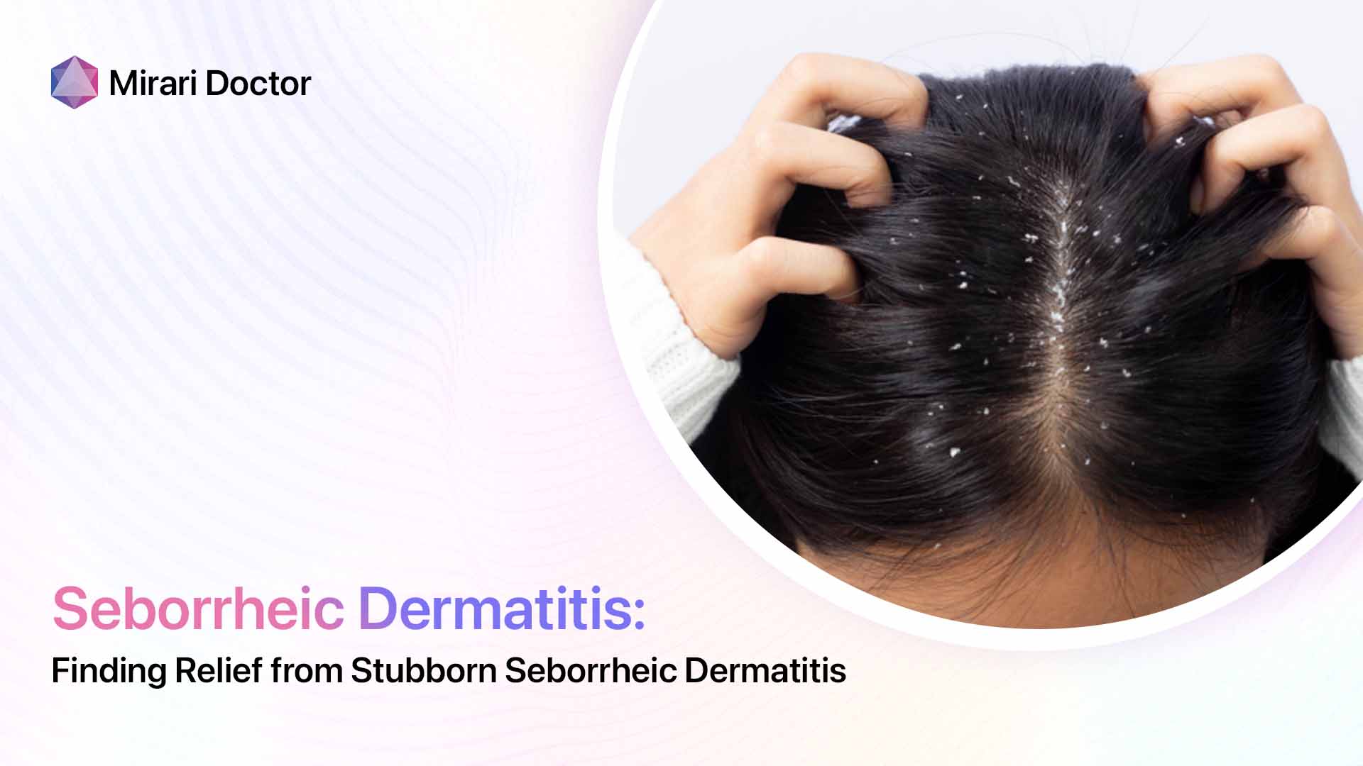 Finding Relief from Stubborn Seborrheic Dermatitis